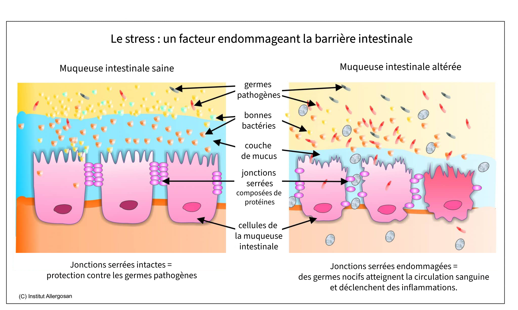 L'hyperperméabilité intestinale – OMNi-BiOTiC®