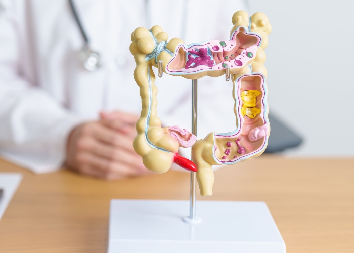 Les antibiotiques augmentent-ils le risque de cancer du côlon