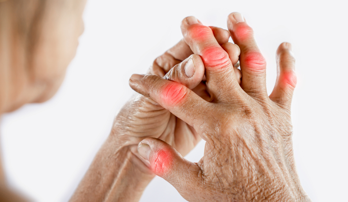 La goutte : un excès d'acide urique - OMNi-BiOTiC®