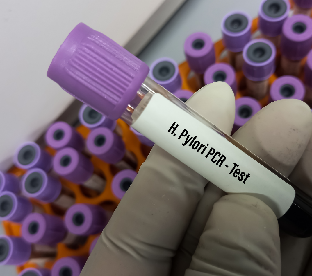 Helicobacter pylori - príznaky, test a liečba